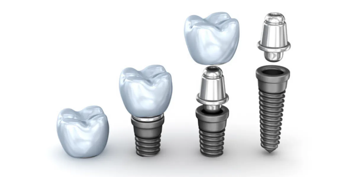 Oral surgery | Wadebridge | Number 65 Dental & Implant Clinic