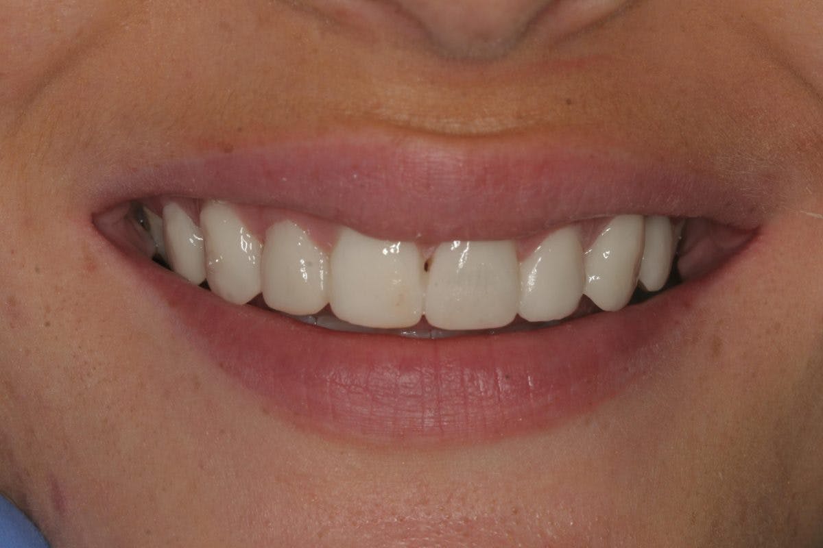 Mottled Smiles | The Smile sPA