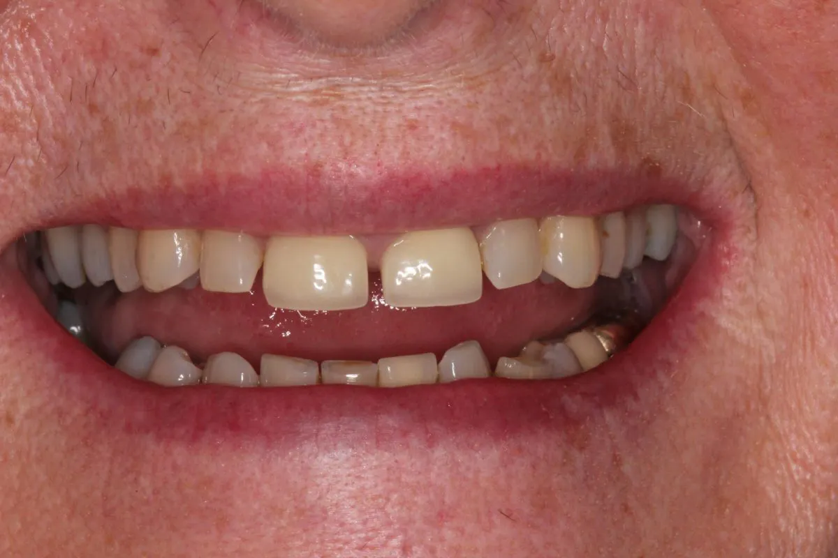 Personalised Smiles | The Smile Spa